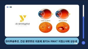 와이투솔루션, 건성 황반변성 치료제 미FDA RMAT 지정 소식에 상승세_돈의맛 안효원 아나운서